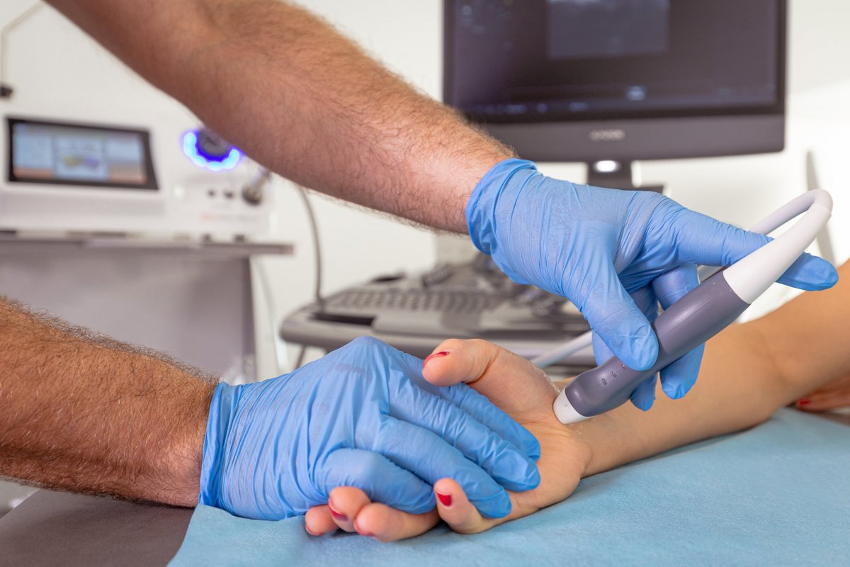 Zespół cieśni nadgarstka. Definicja, objawy, diagnoza i leczenie ...
